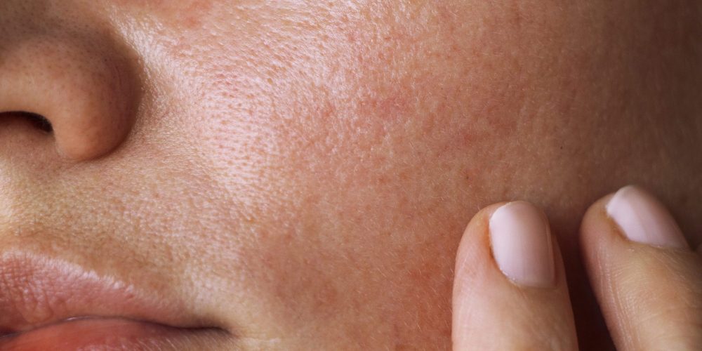 Psychodermatology – An Introduction to the Interaction Between the Mind ...